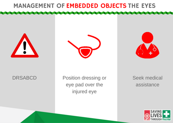St John Victoria Blog | Eye Injury First Aid Tips - Learn How To ...