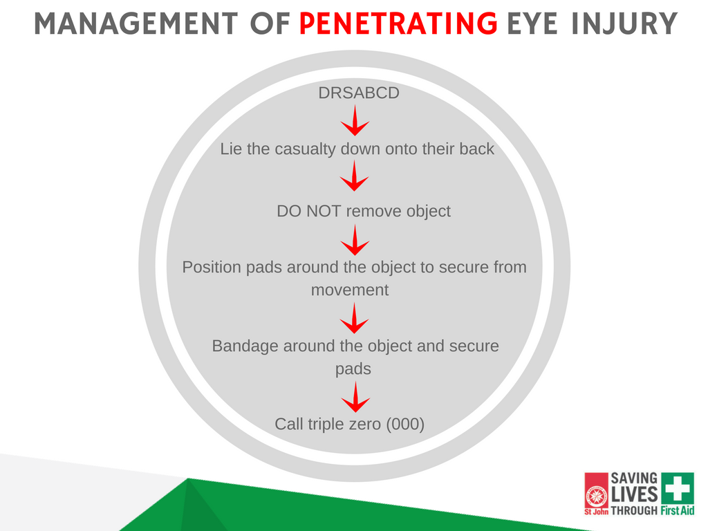 St John Victoria Blog | Eye Injury First Aid Tips - Learn How To ...