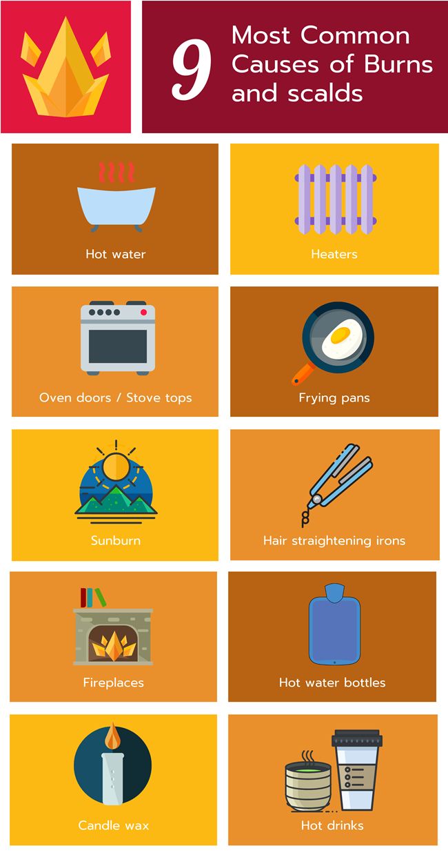 St John Victoria Blog How To Treat And Recognise A Burn Effective