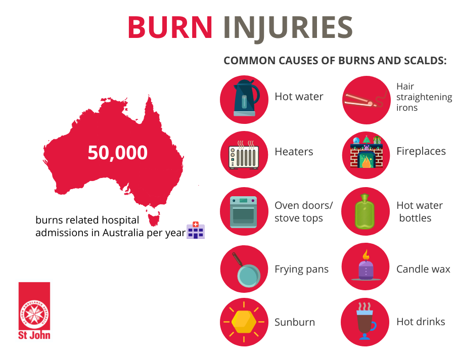 How To Treat And Recognise A Burn Effective First Aid For Burns